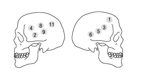 Extended ebook content for BEYOND IQ: Exercise 23 DIY TDCS